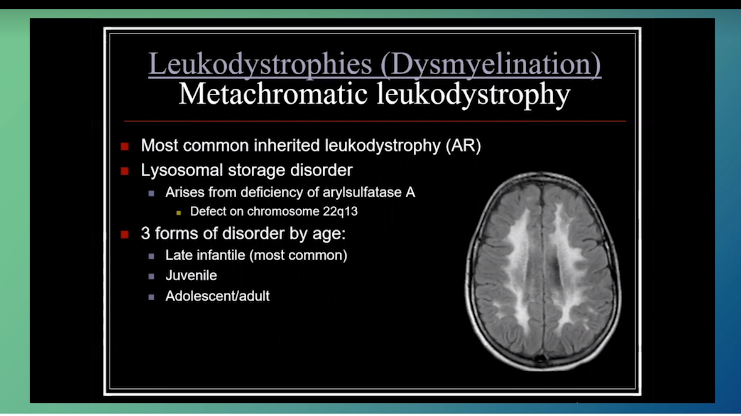 Metachromatic Leukodystrophy