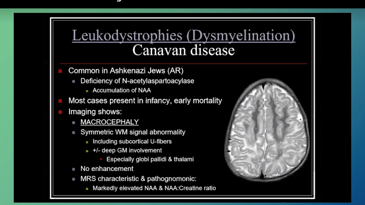 How Common Is Canavan Disease