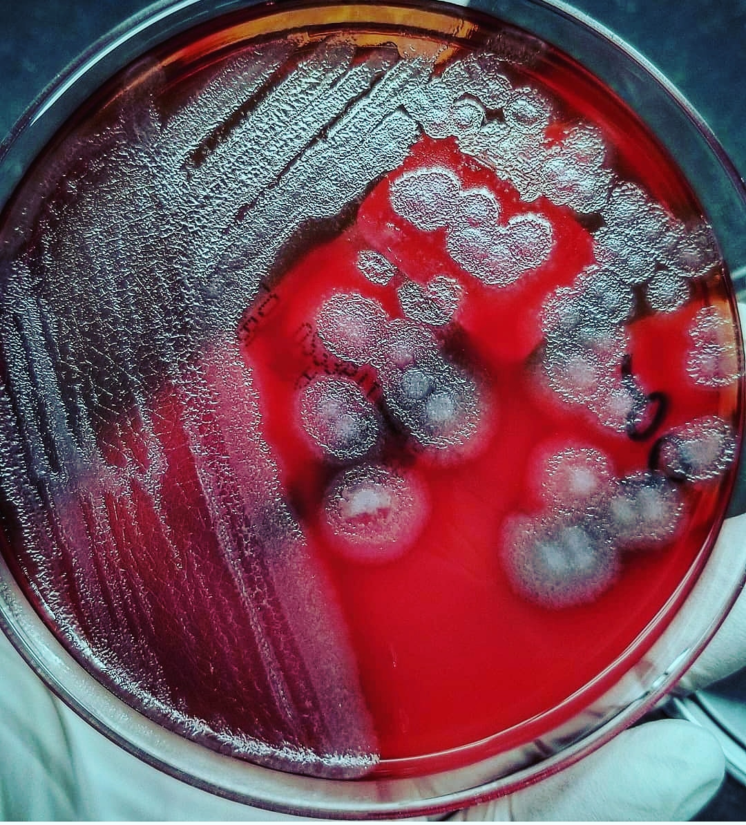 Pseudomonas Aeruginosa On Macconkey Agar