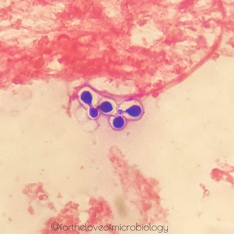 Cryptococcus Neoformans Gram Stain