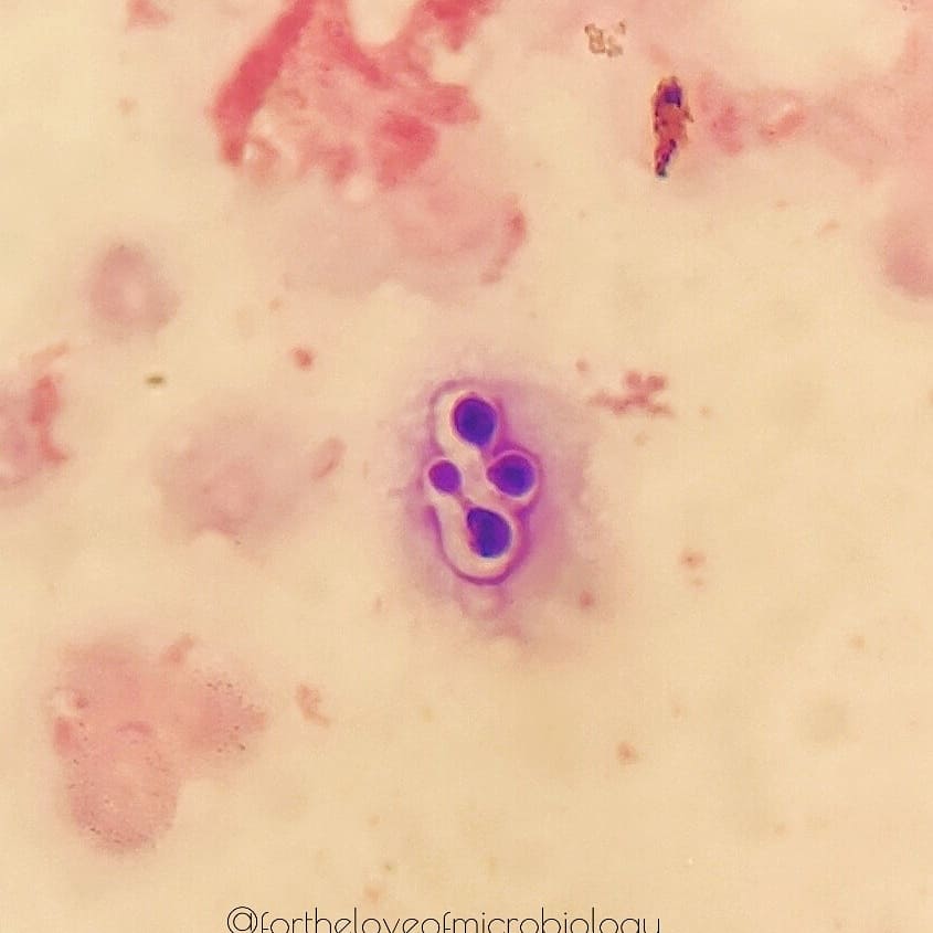 Cryptococcus Neoformans Gram Stain