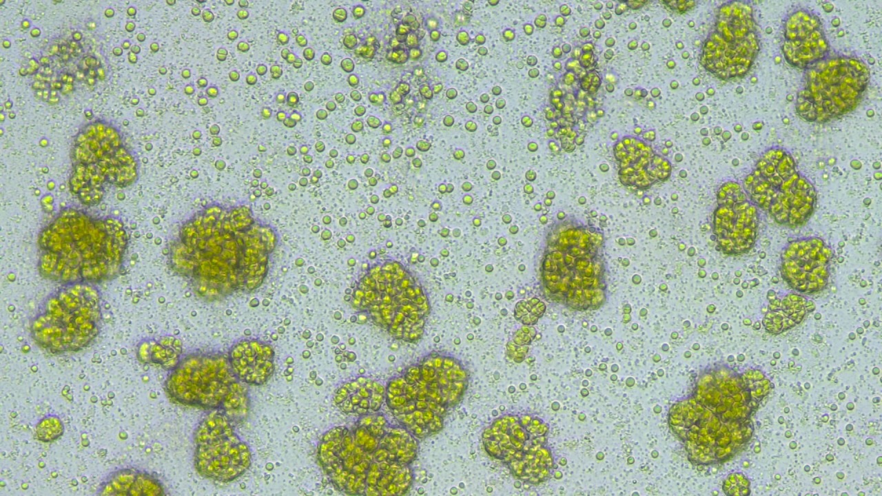 Unicellular Cyanobacteria