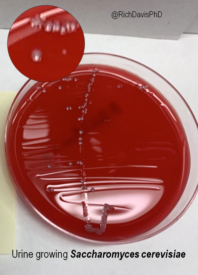 Saccharomyces Cerevisiae Plate