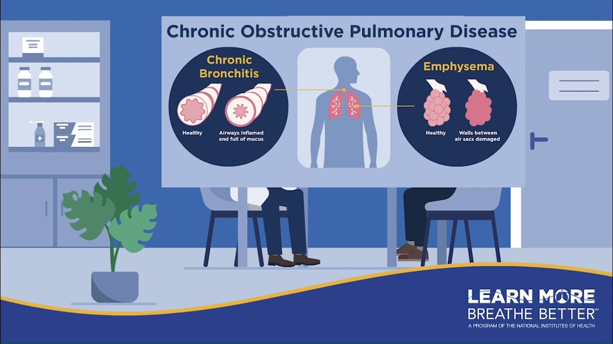 What is COPD? COPD stands for Chronic Obstructive Pulmonary Disease ...