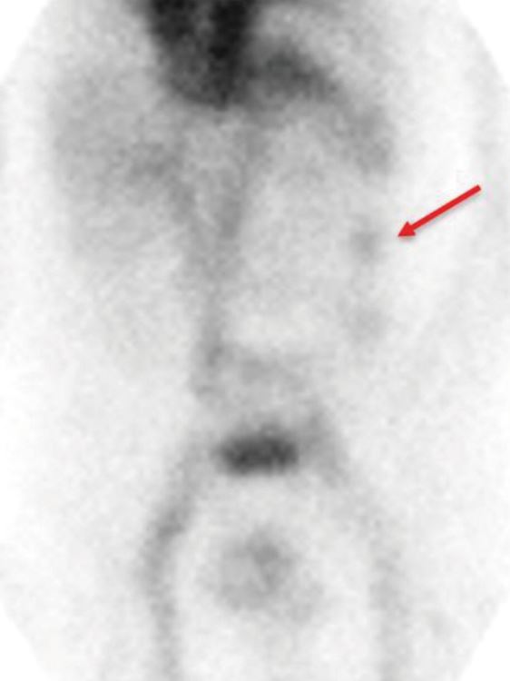 #MedTwitter - we're back with another tweetorial 🥳 Thanks @john ...