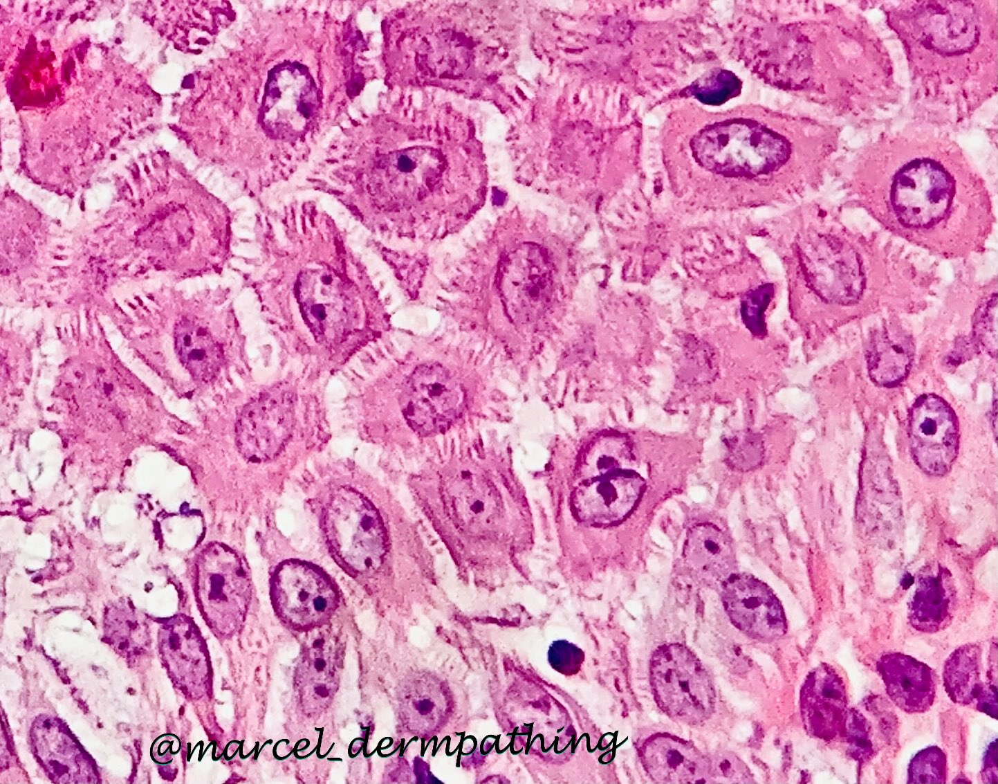 Desmosomes Histology
