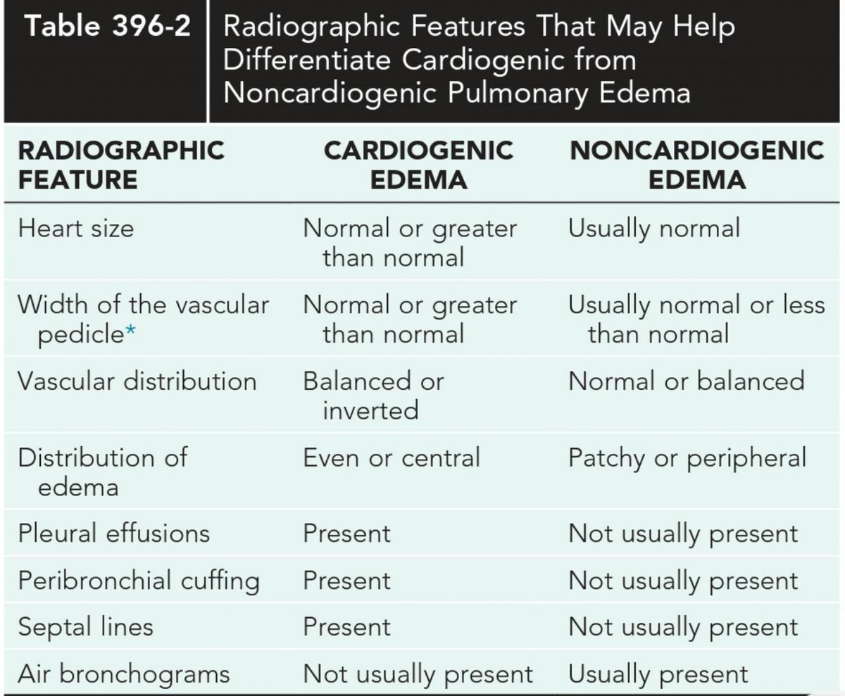 Noncardiogenic Pulmonary Edema Imaging – QIZR