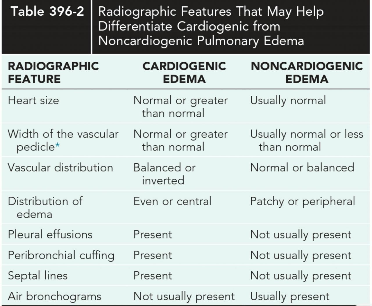 Cardiogenic Pulmonary Edema