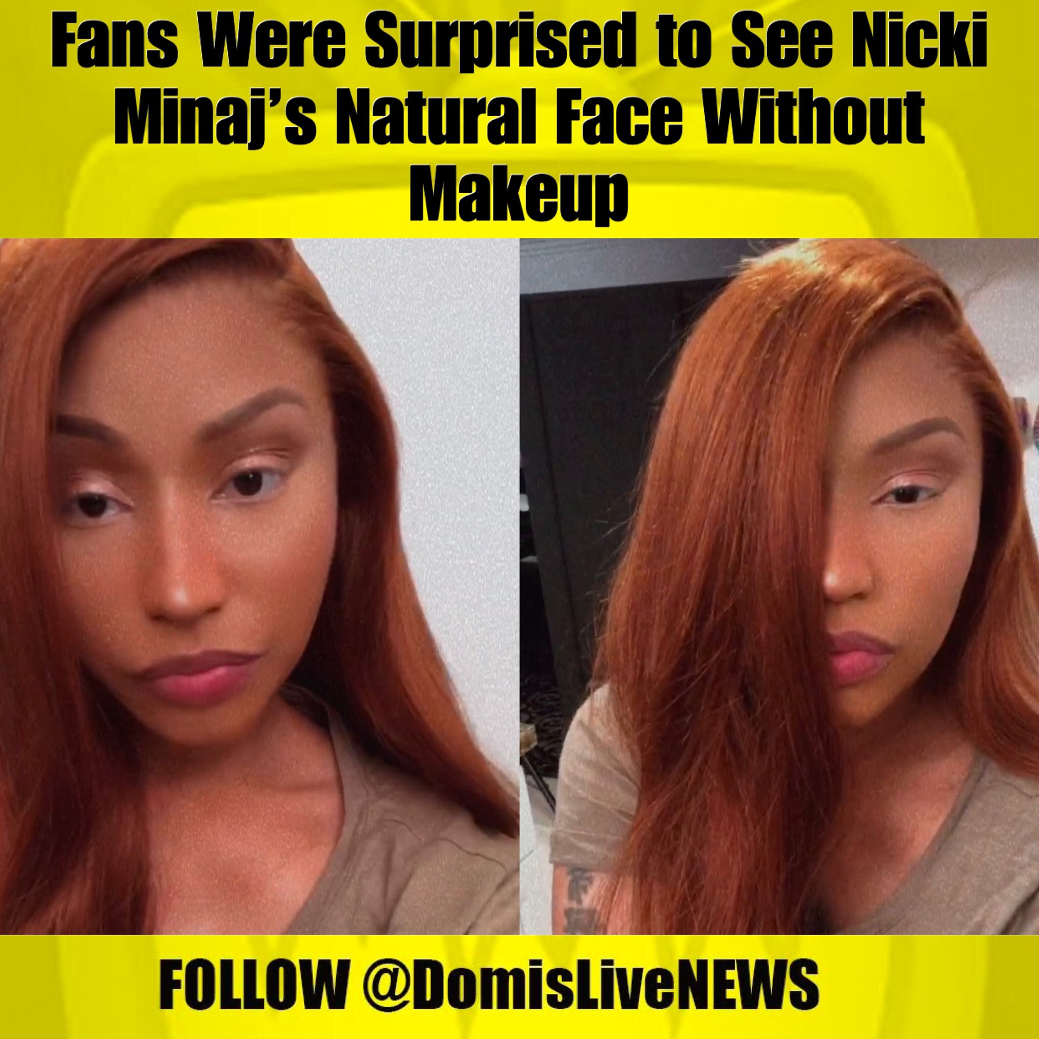 Nicki Minaj Real Face Without Makeup