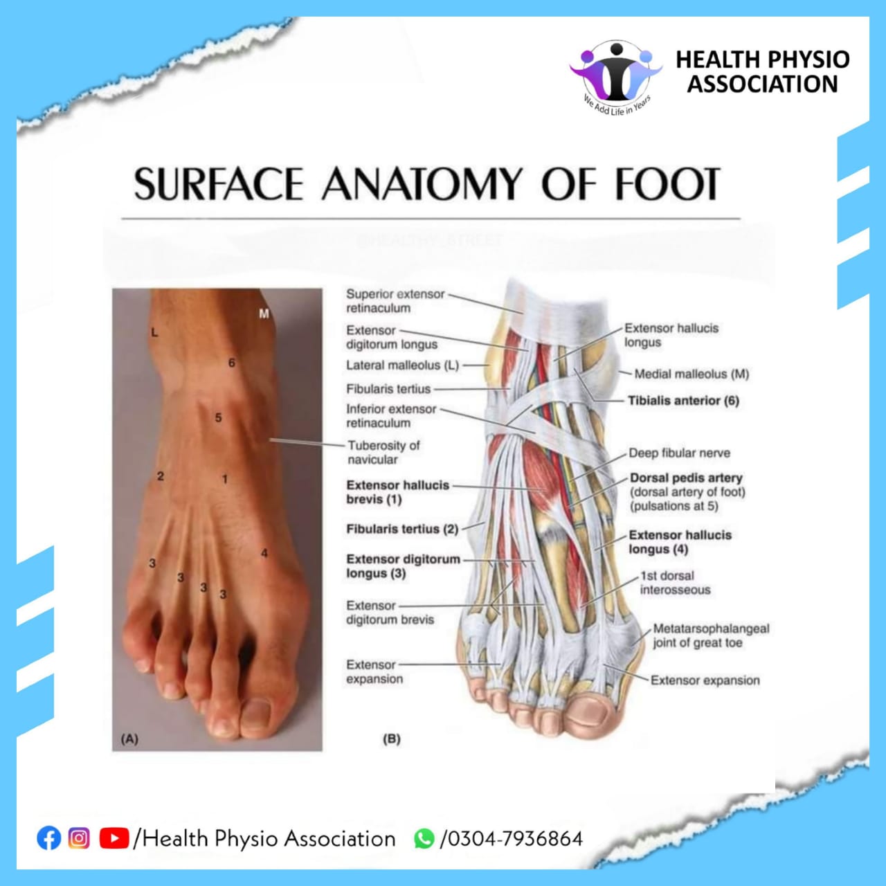 Surface Anatomy Foot Navicular Physiopedia