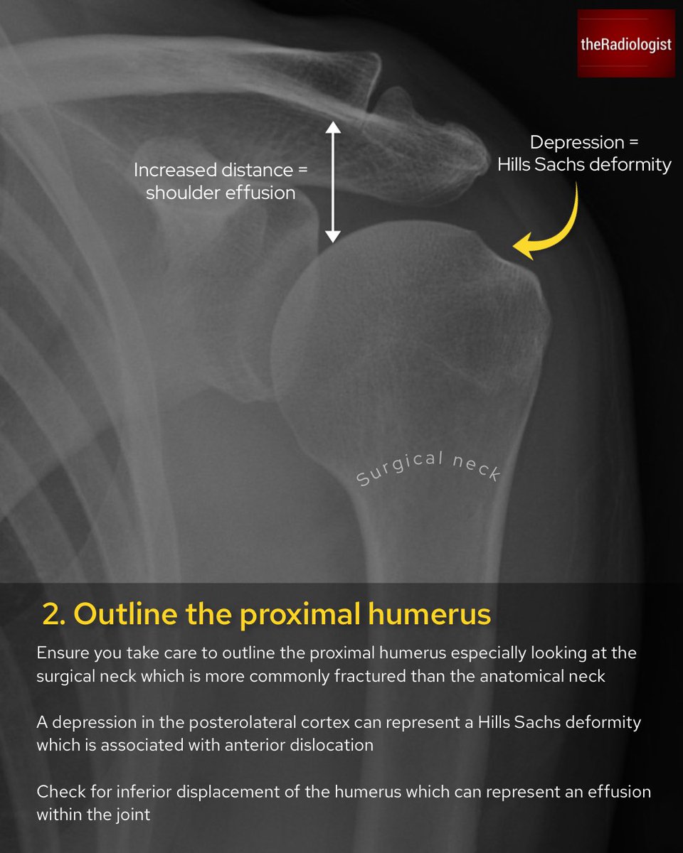 Humerus X Ray Labeled