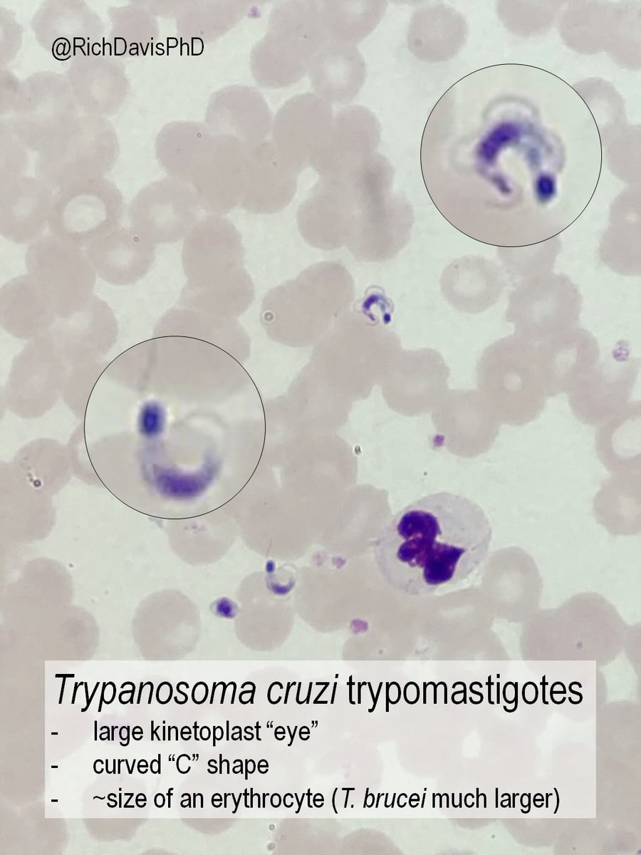 Trypanosoma Cruzi Trypomastigotes
