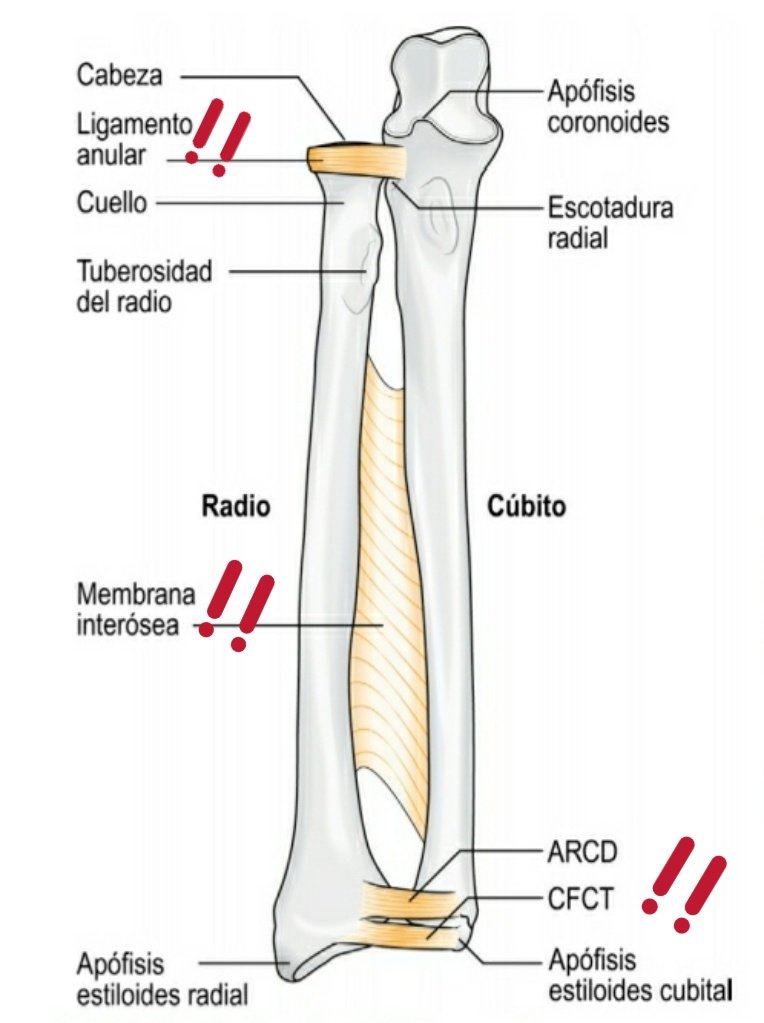 Apófisis Coronoides Cúbito