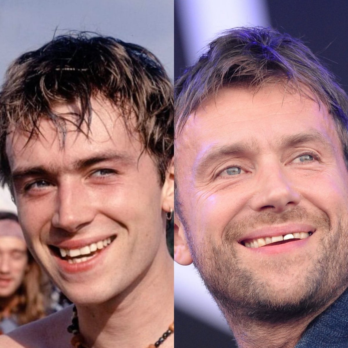 Damon Albarn Teeth
