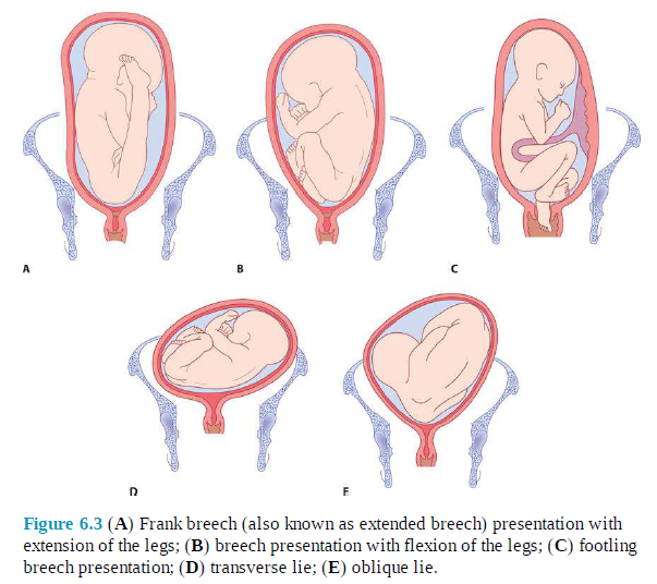 Oblique Lie Presentation