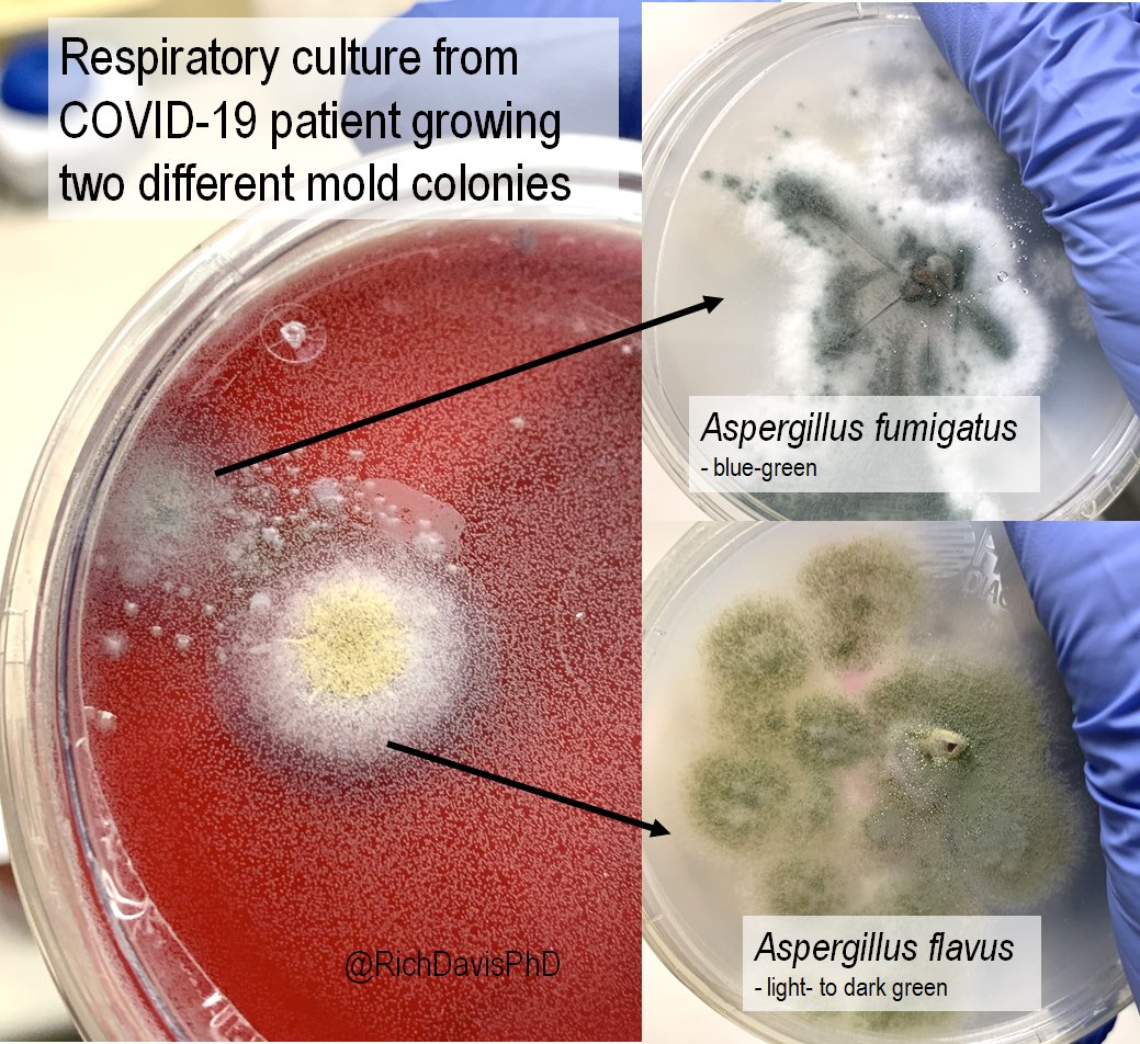 Aspergillus Fumigatus Culture