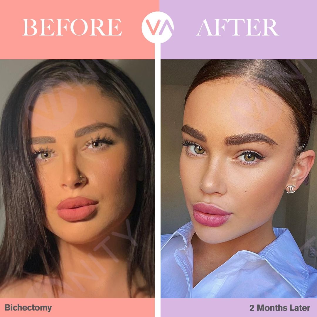 Prominent Cheekbones Vs High Cheekbones XユーザーのVanity