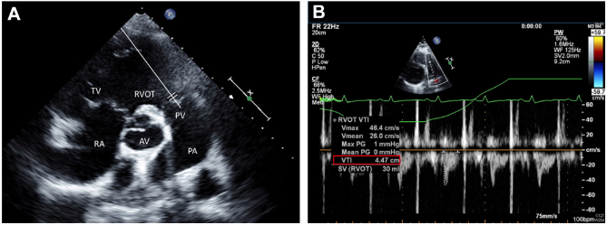 Echo Hands-on Training Course 2주차 : 네이버 블로그