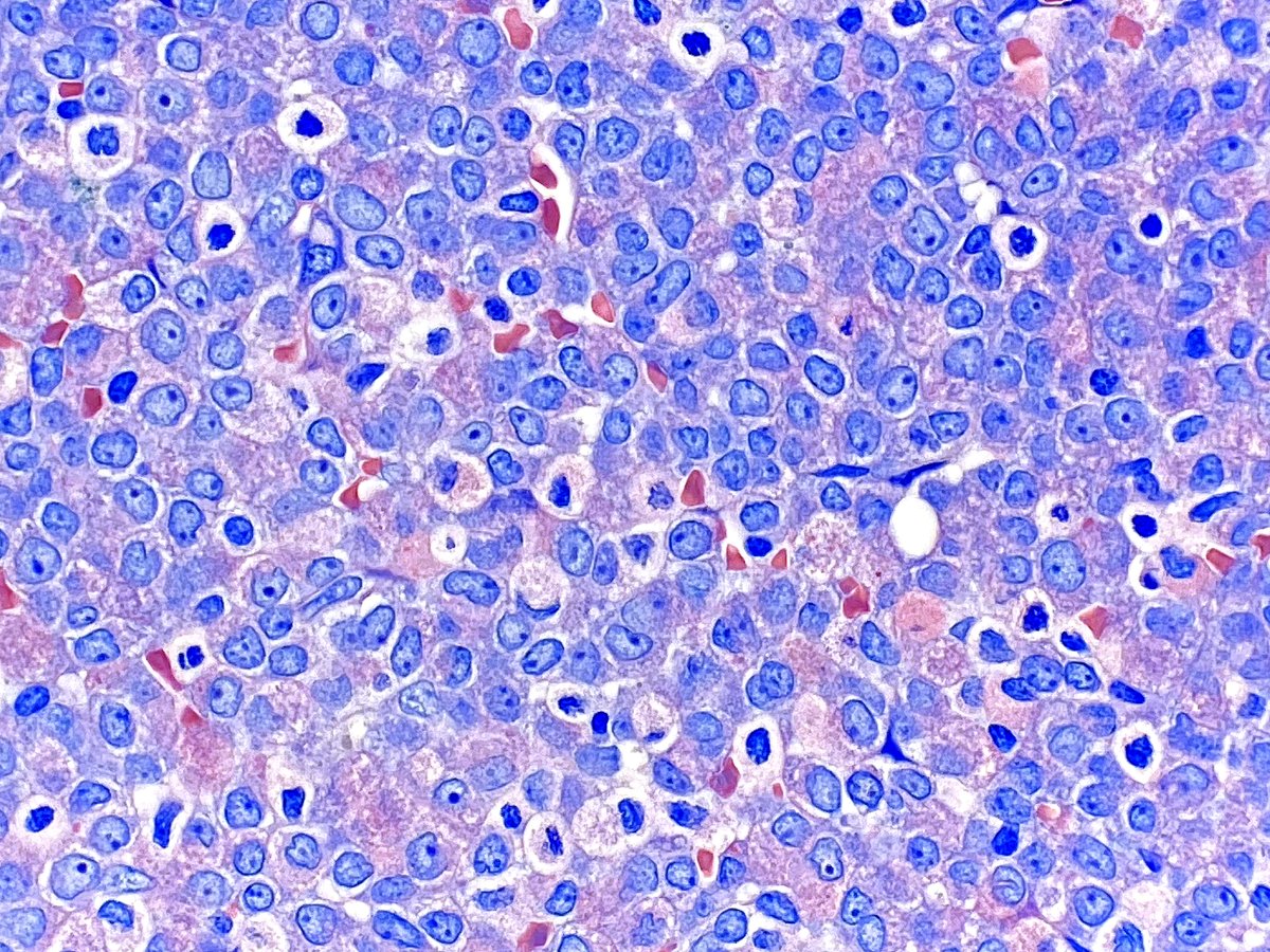 Giemsa, May-Grunwald Histology Staining Procedure, 42% OFF