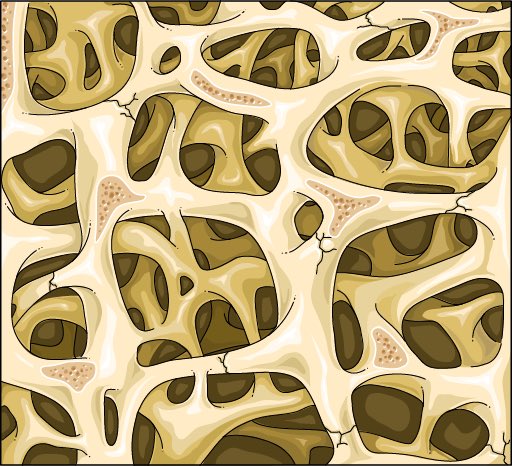 6. Bone profile – @PalingClaire
