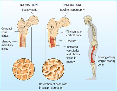 6. Bone profile – @PalingClaire