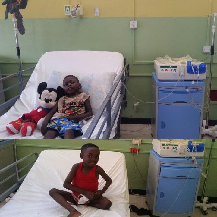 Peritoneal Dialysis In Children