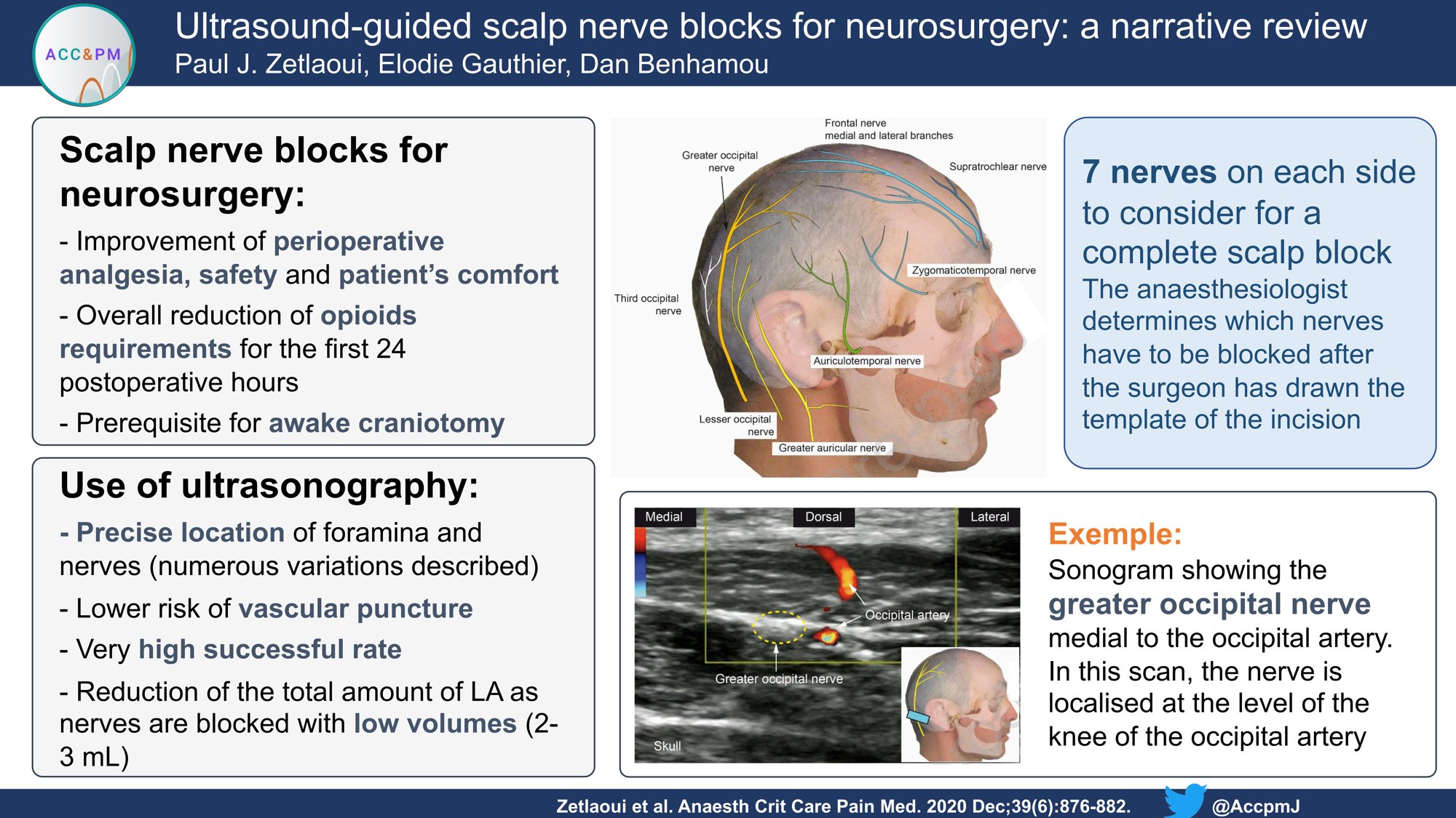 Auriculotemporal Nerve Block