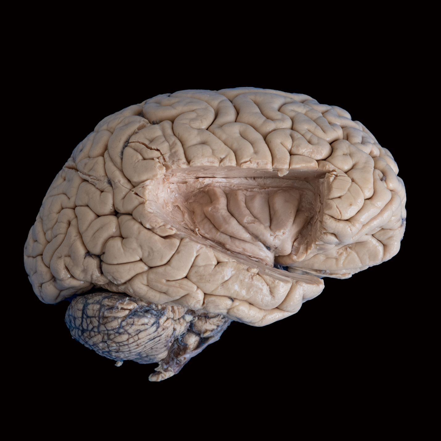 Insula Brain Model