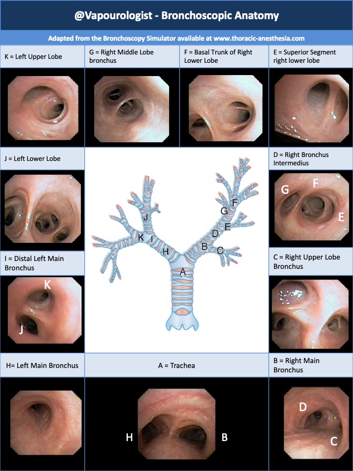 Bronchoscopy Anatomy