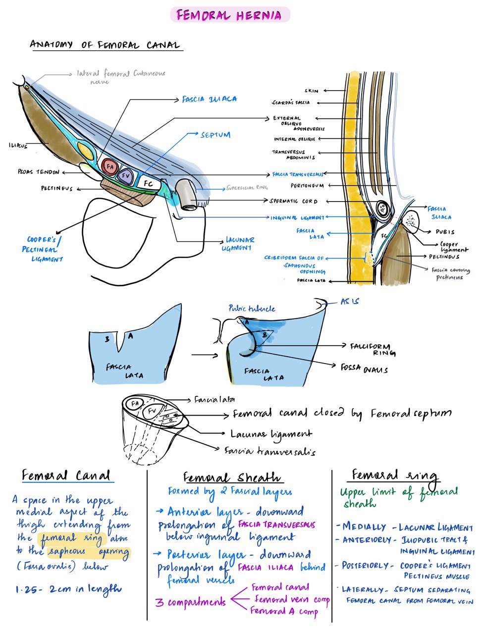 Femoral Ring Hernia