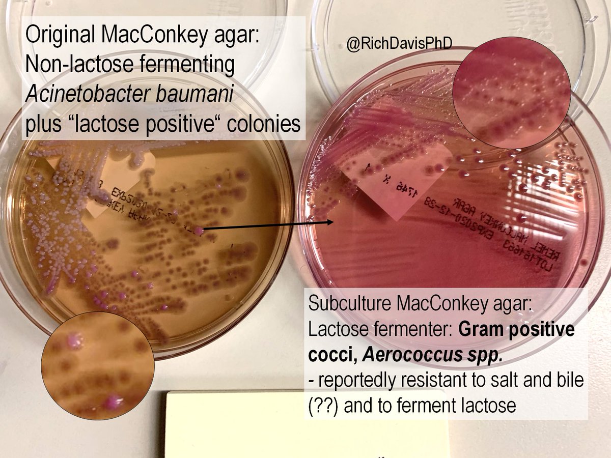 Macconkey Agar Lactose Fermentation