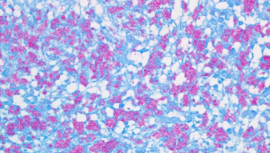 Images of Infectious Diseases Our @MayoMN_IMRes residents presented a ...