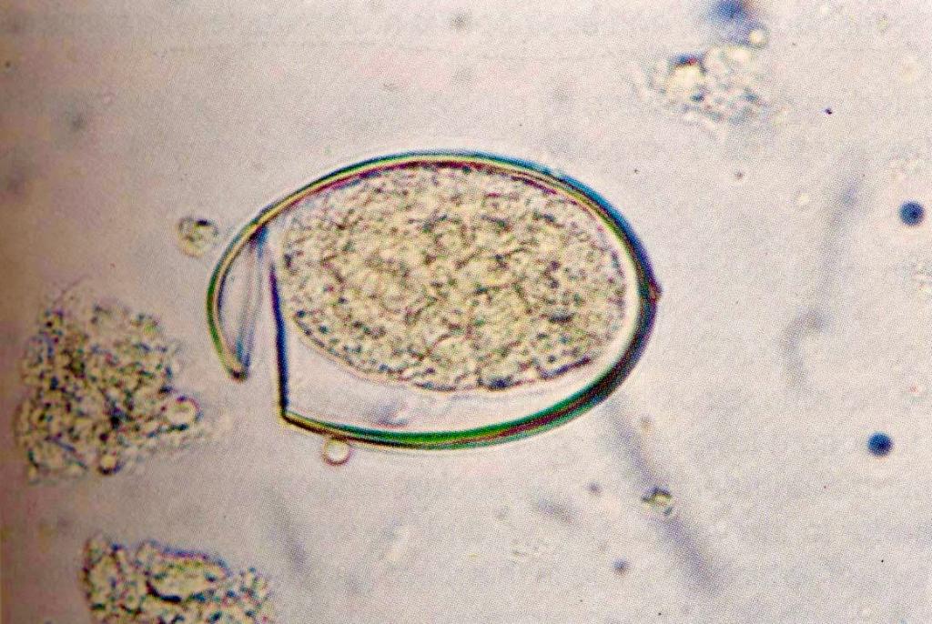 Diphyllobothrium Latum Larvae