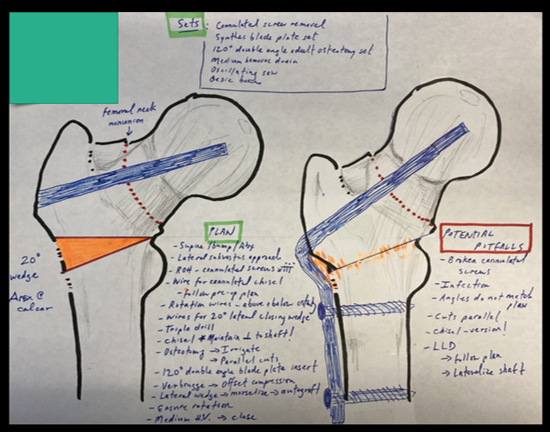 Varus Vs Valgus Fracture