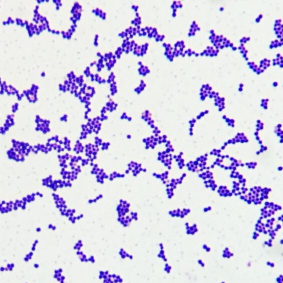 Staphylococcus Epidermidis Gram Stain