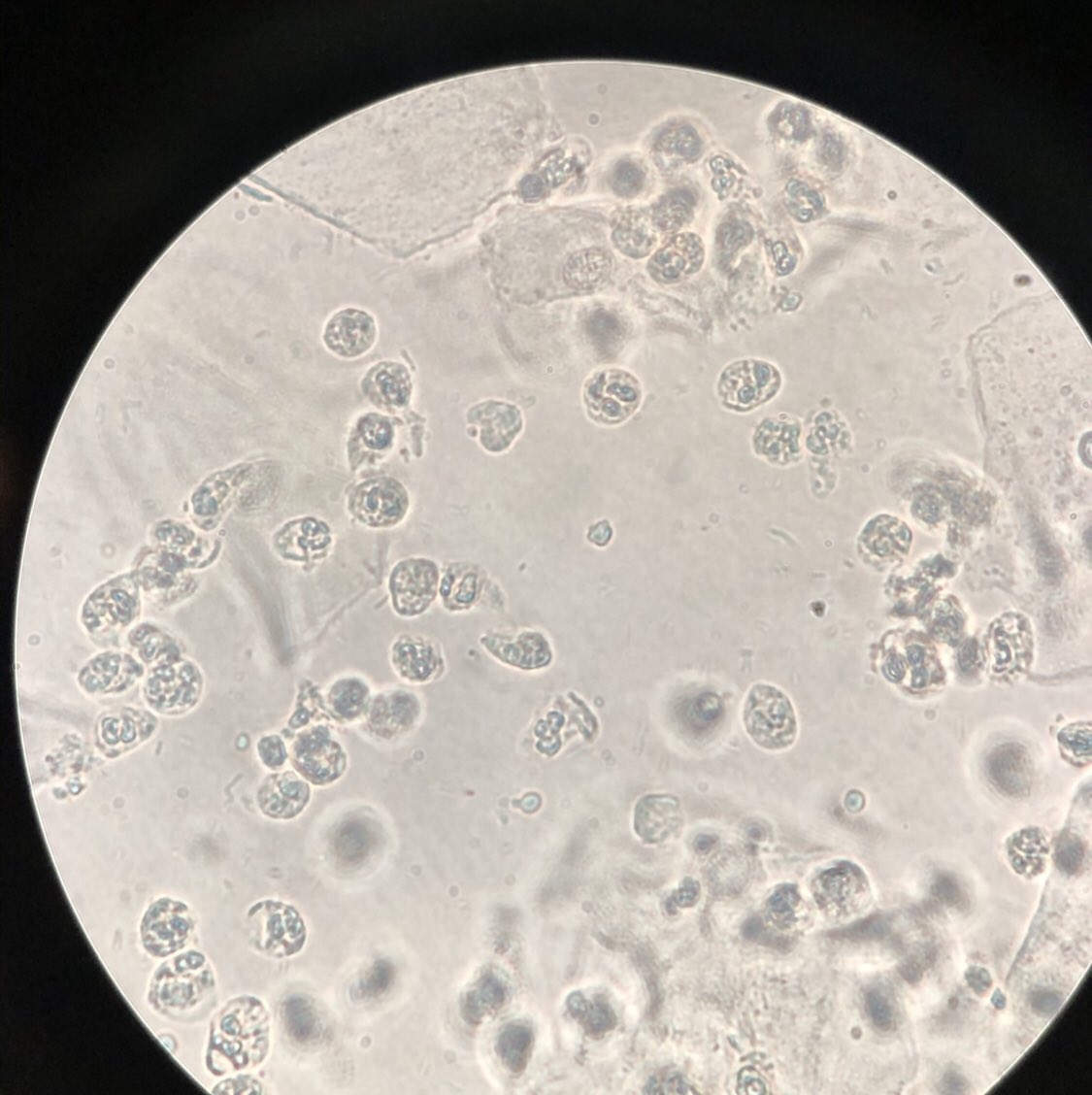 Blastoconidia