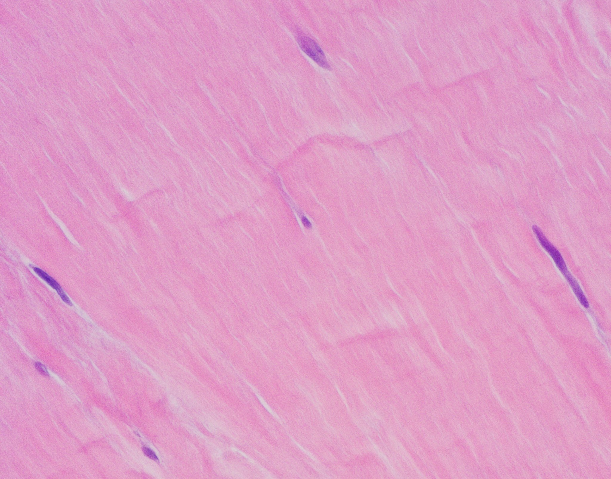 Dense Regular Connective Tissue Histology