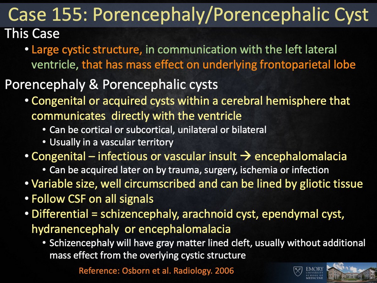 Porencephaly Vs Schizencephaly