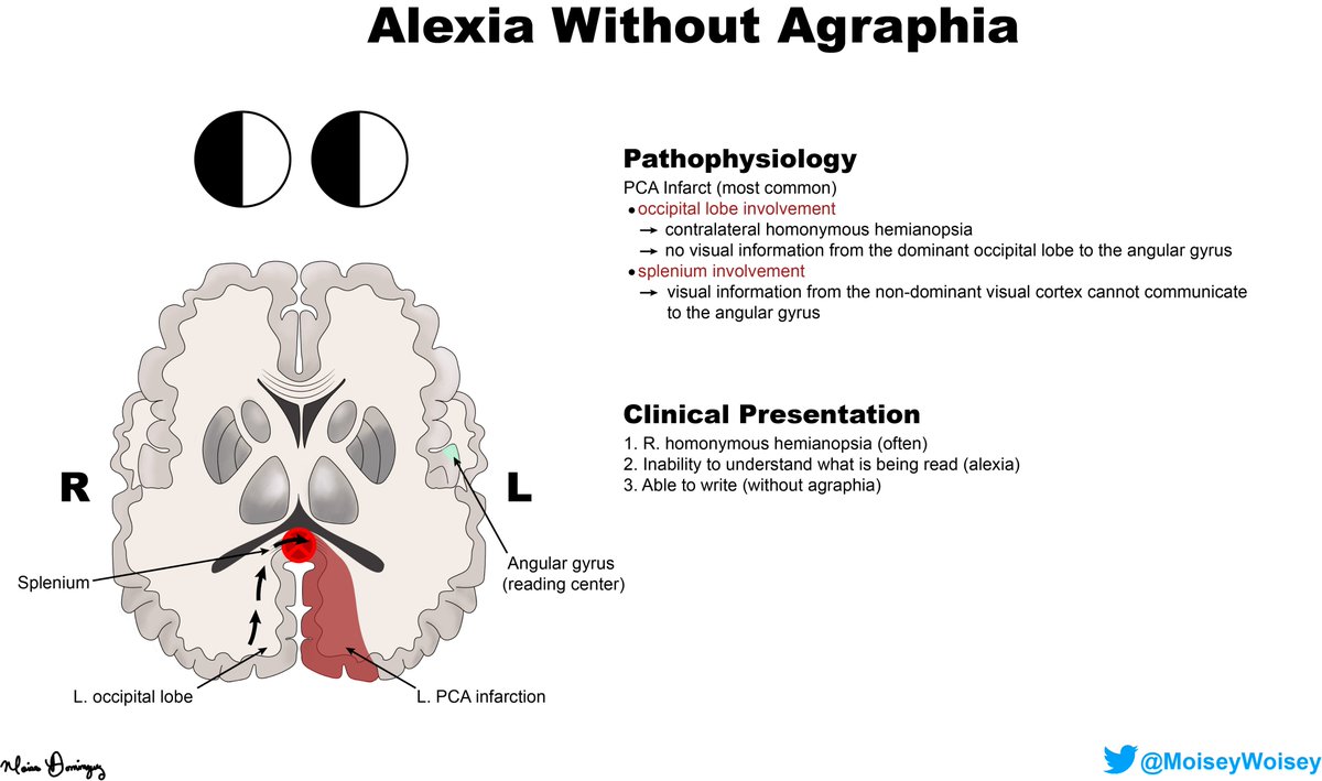 Trying something new! Check out my illustration on Alexia without ...