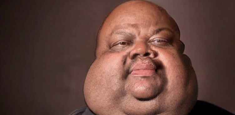 Fattest Black Man In The World