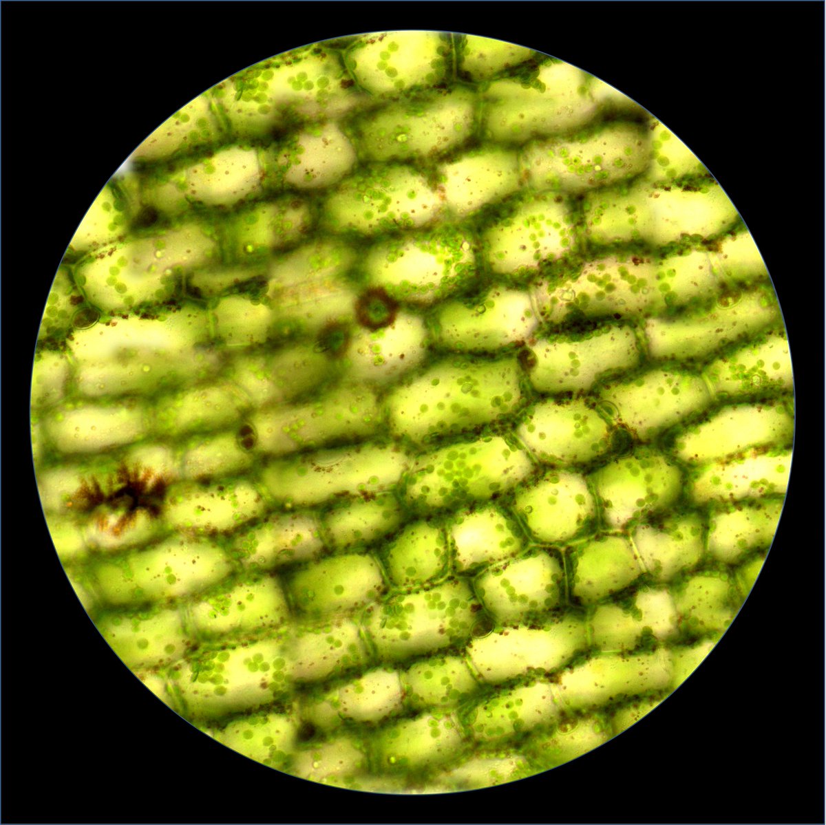 Elodea Cell Under Microscope 100x Biojournal: Microscope View Of