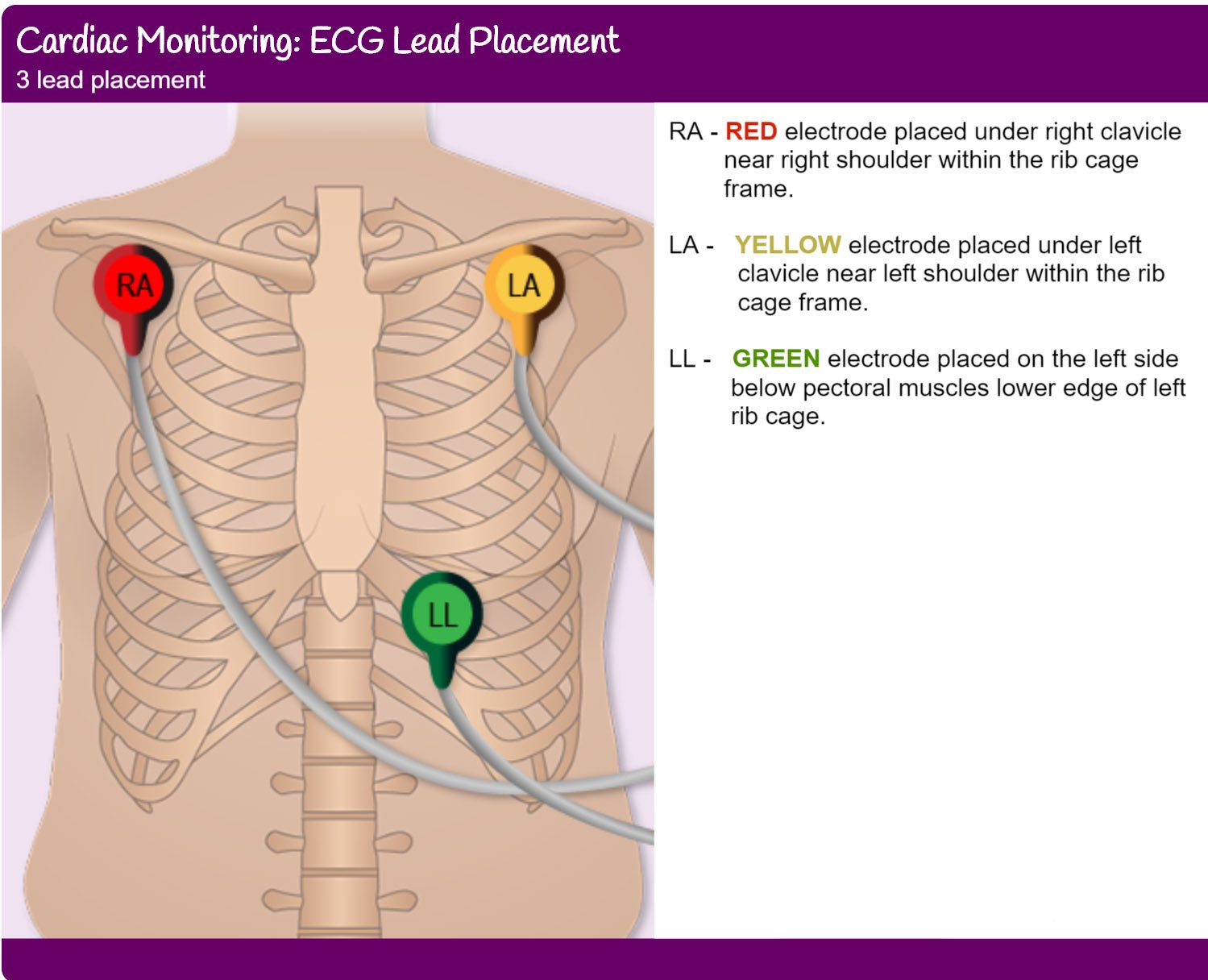 12 Lead Ecg Placement Mnemonic