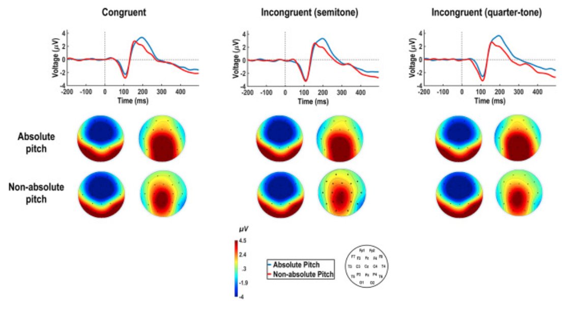 CORTEX on Twitter: "#ResearchReport Auditory aversion in absolute pitch possessors by @lars ...