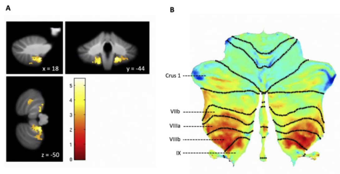 CORTEX on Twitter: "#ResearchReport Power calculations in single-case neuropsychology: A ...