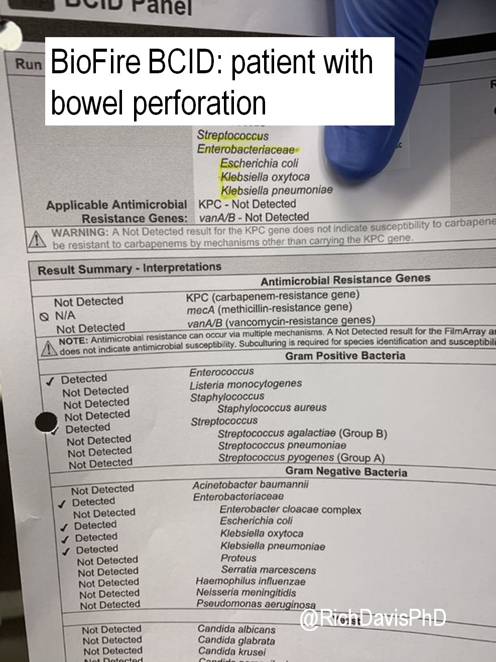 Bcid Number Where To Find Shop Deals | www.micoope.com.gt