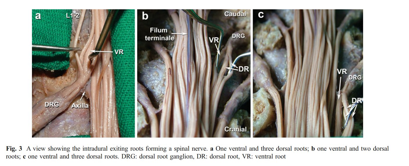 Filum Terminale Cadaver