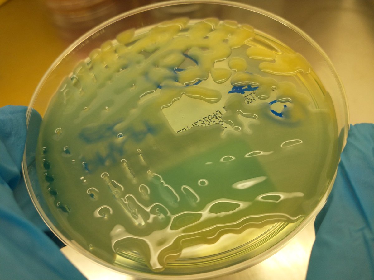 Klebsiella Pneumoniae On Cled Agar