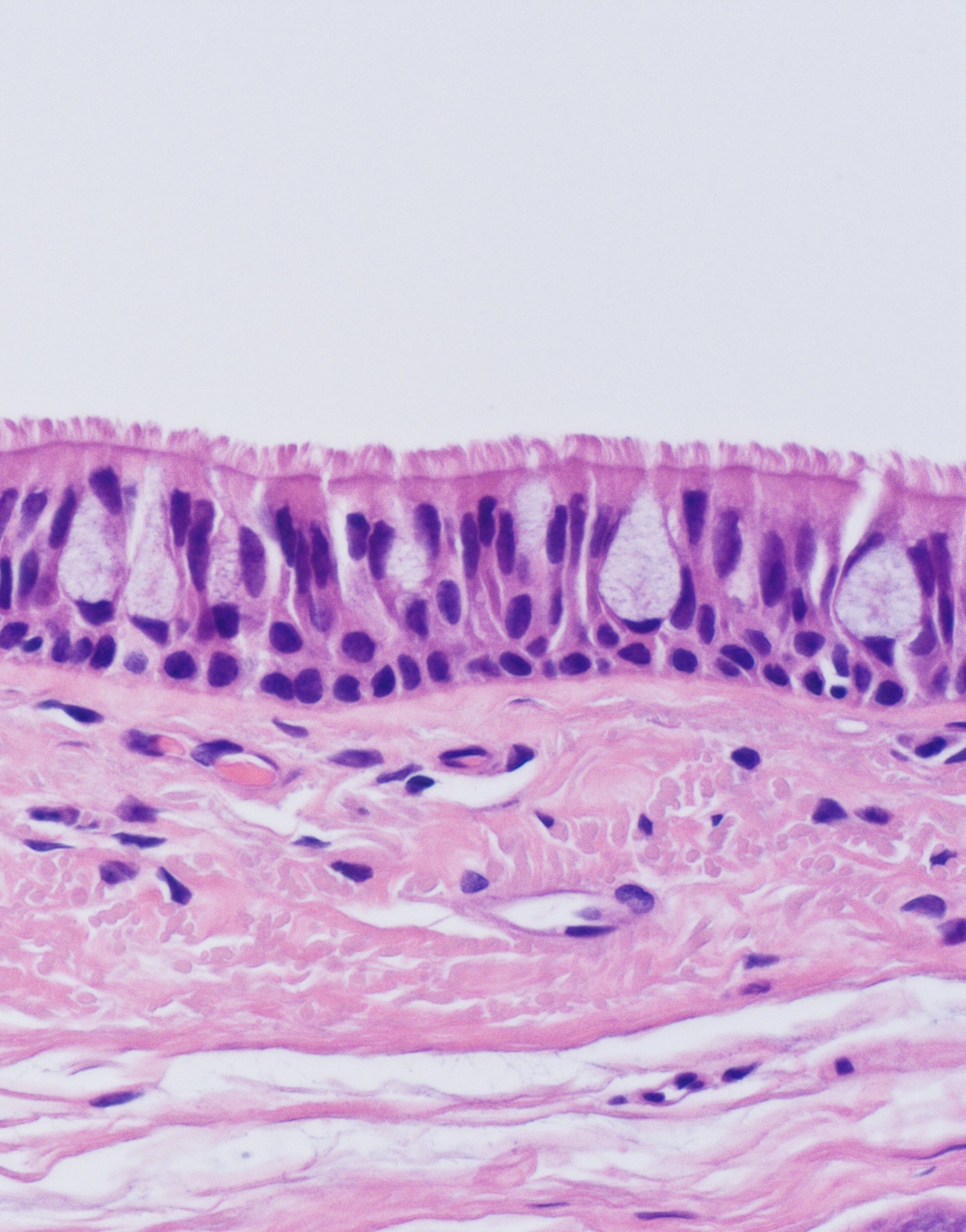 Trachea Histology Diagram