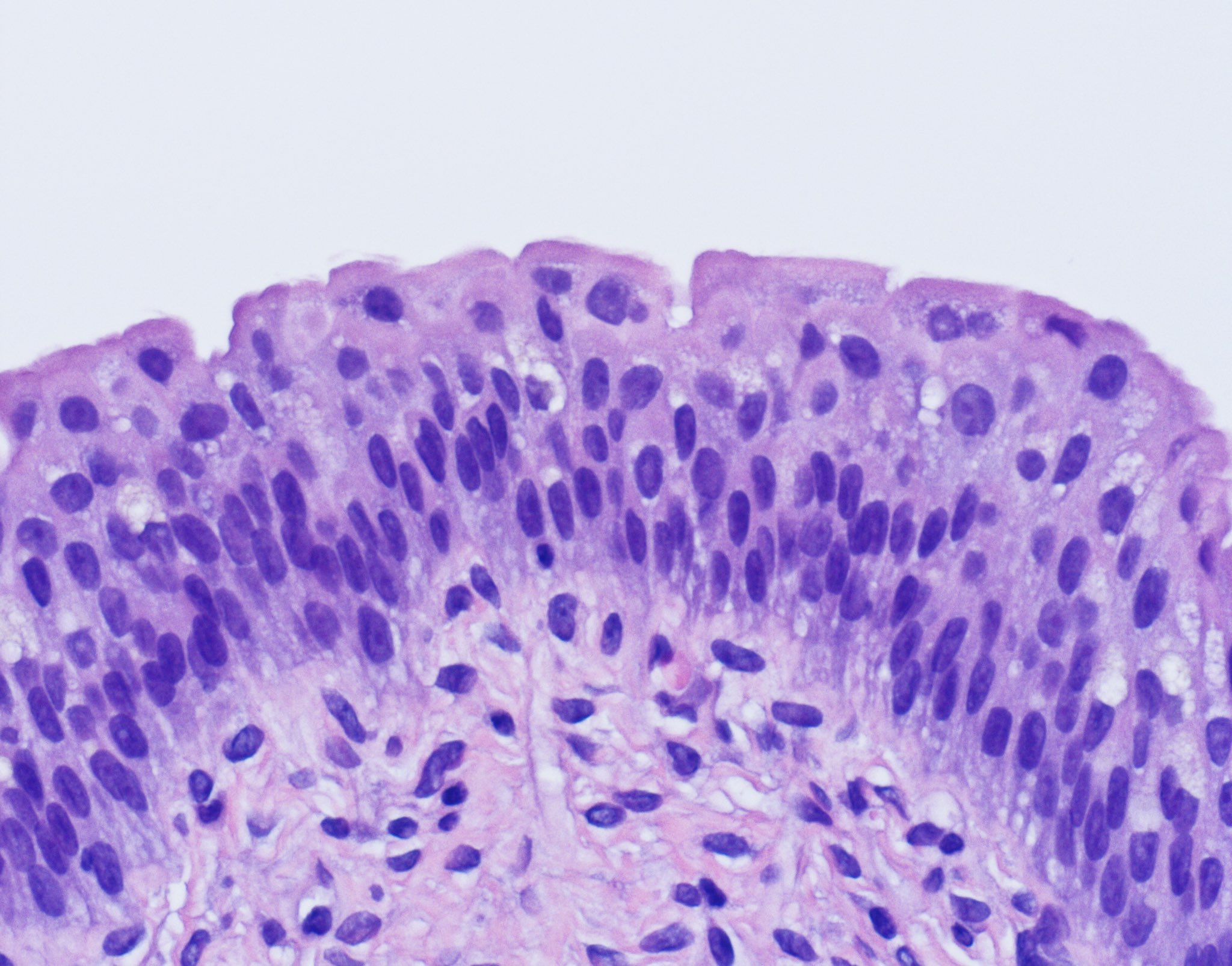 Bladder Histology Bladder Labels Histology