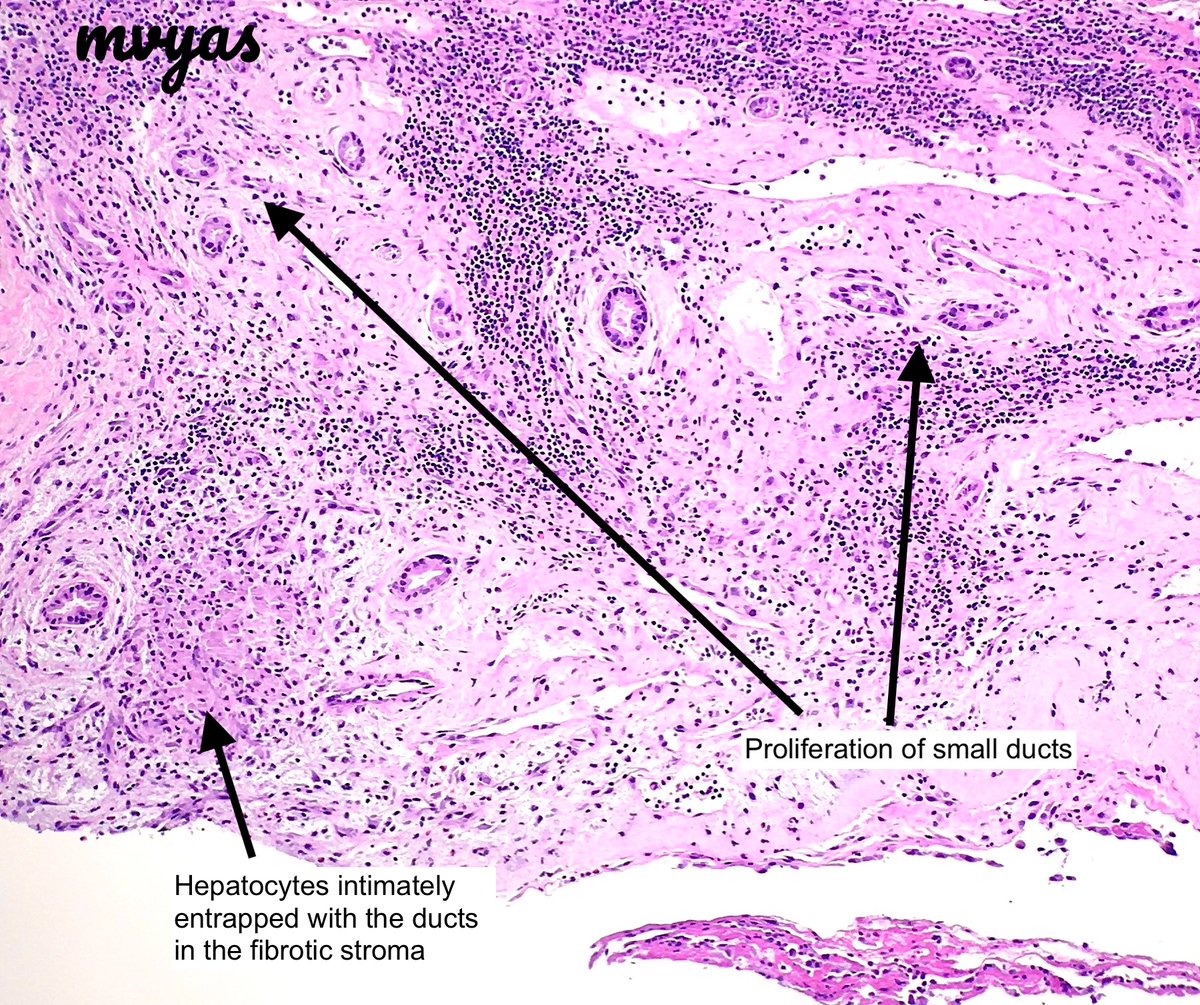 Pathology Outlines Anatomy, Histology Embryology, 46% OFF